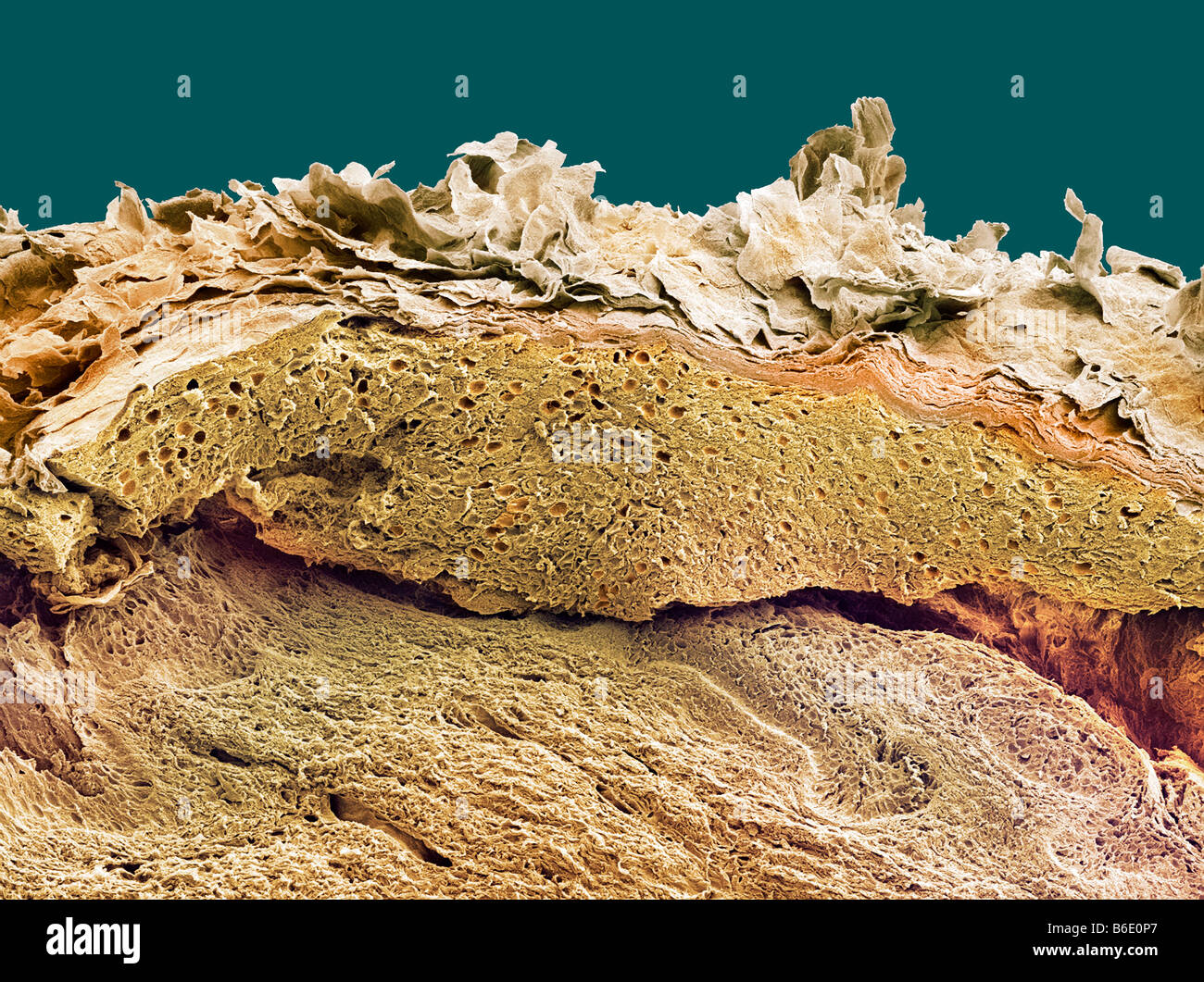 Skin. Coloured scanning electron micrograph(SEM) of a section through ...