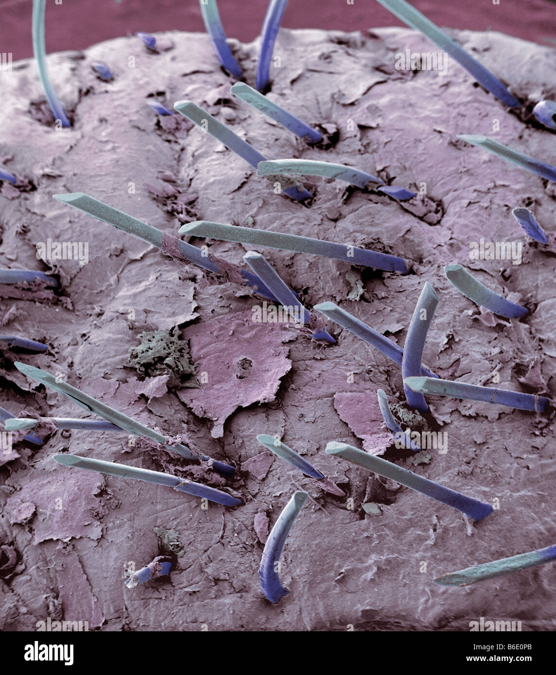 Stubble. Coloured scanning electron micrograph(SEM) of stubble on a man ...