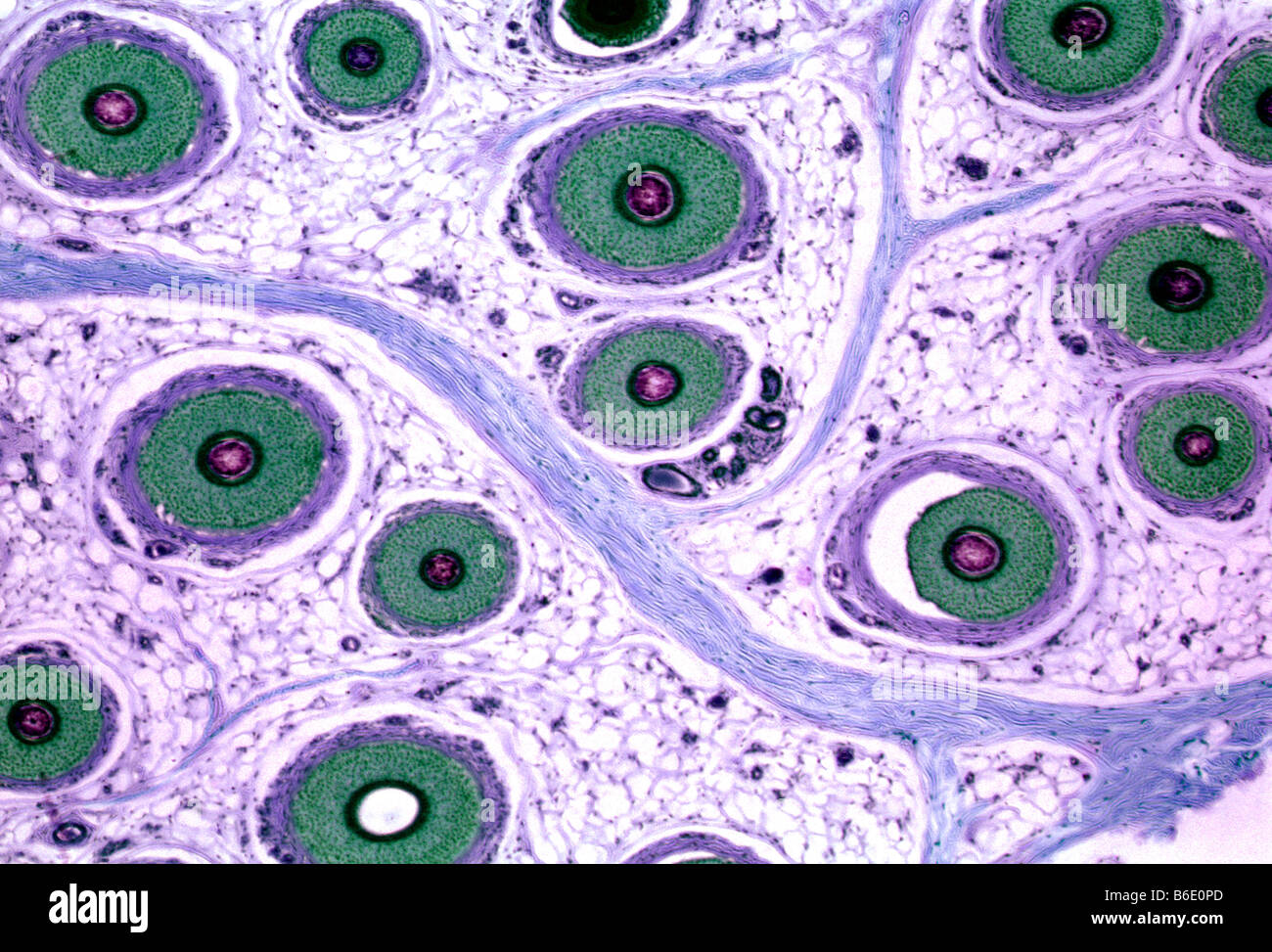 Hair follicles. Coloured light micrograph of a section through hairs of ...