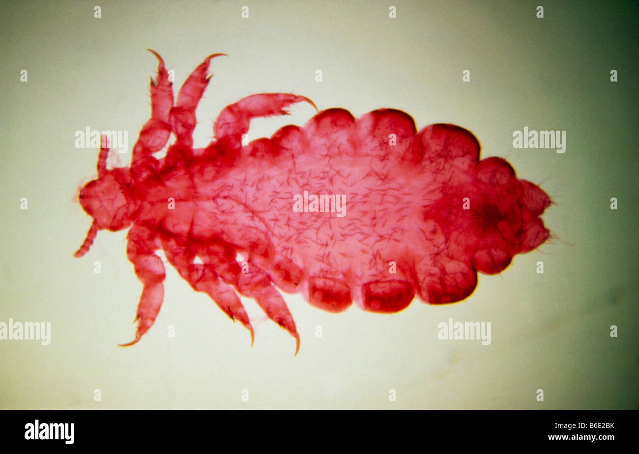 Human body louse, Light micrograph of a female of the human body louse ...