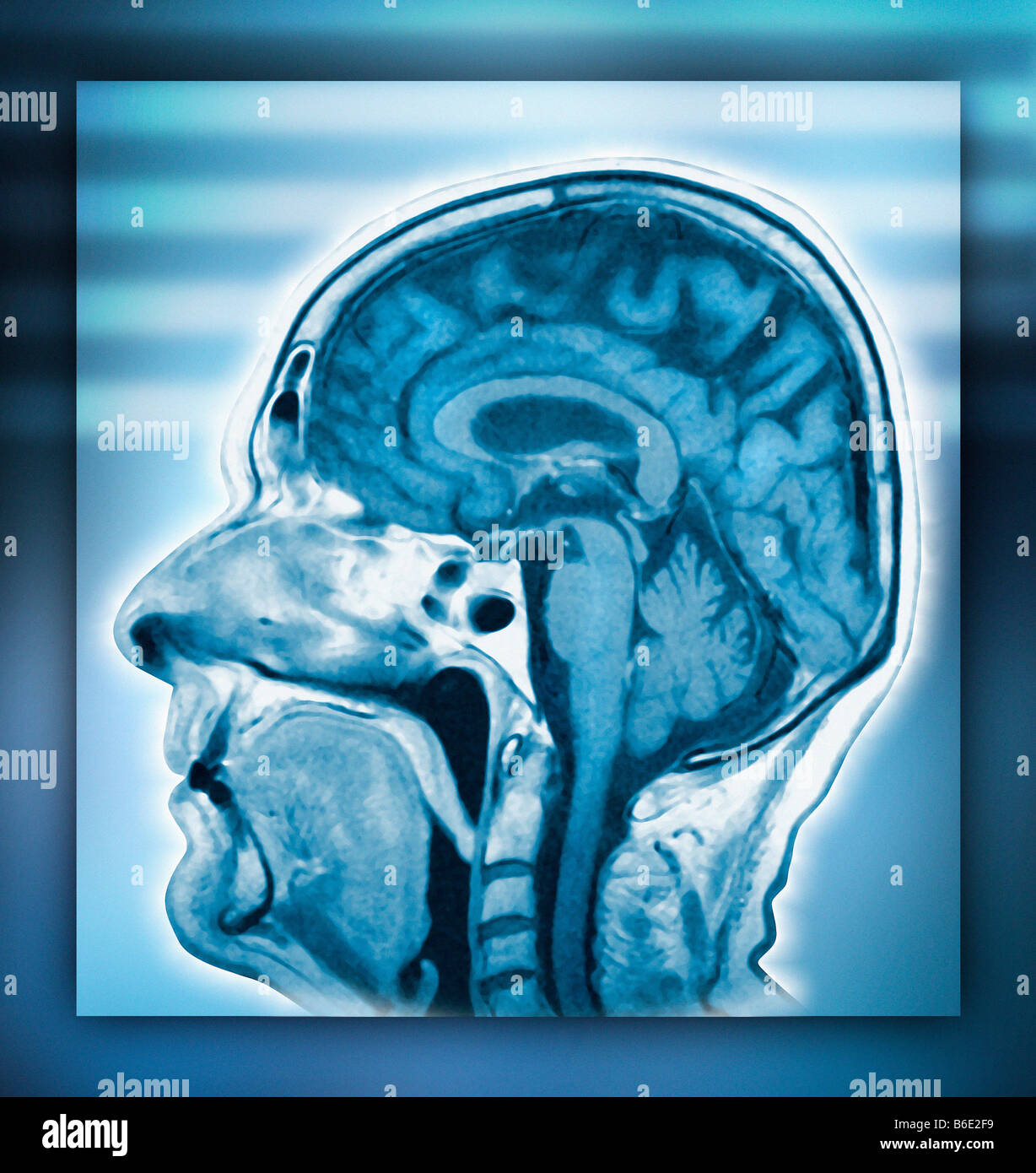 Coloured mri scan human body hi-res stock photography and images - Alamy