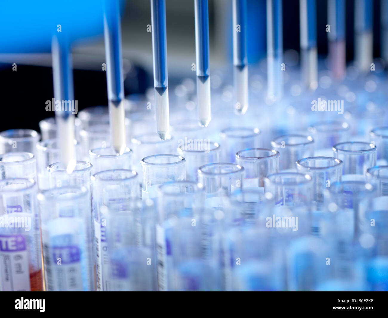 Automated blood sample testing. These samples are being tested for HIV ...