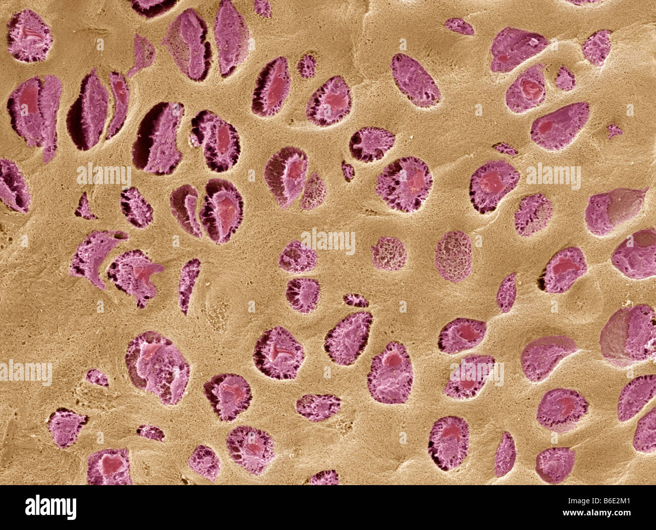 Hyaline cartilage. Coloured scanning electronmicrograph (SEM) of a freeze-fractured section ...
