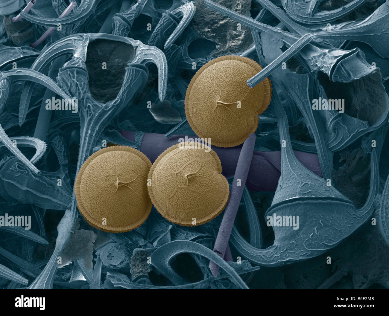 Dinoflagellates Under Electron Microscope