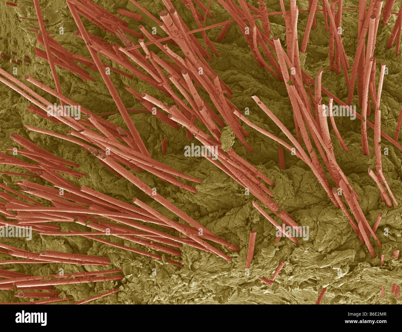 Scanning electron microscope images hi-res stock photography and images ...