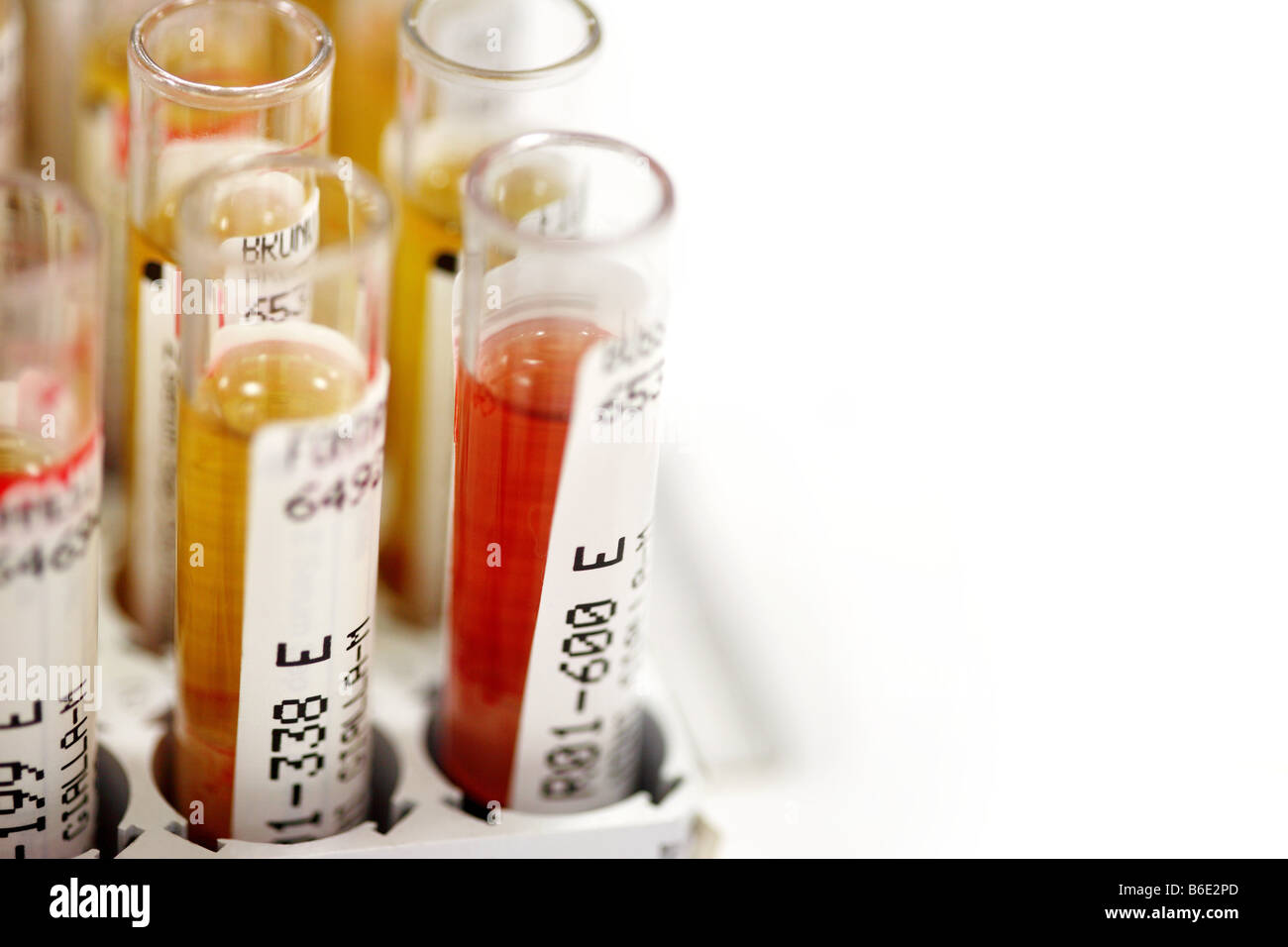 Blood samples. Barcoded test tubes containing blood samples Stock Photo ...
