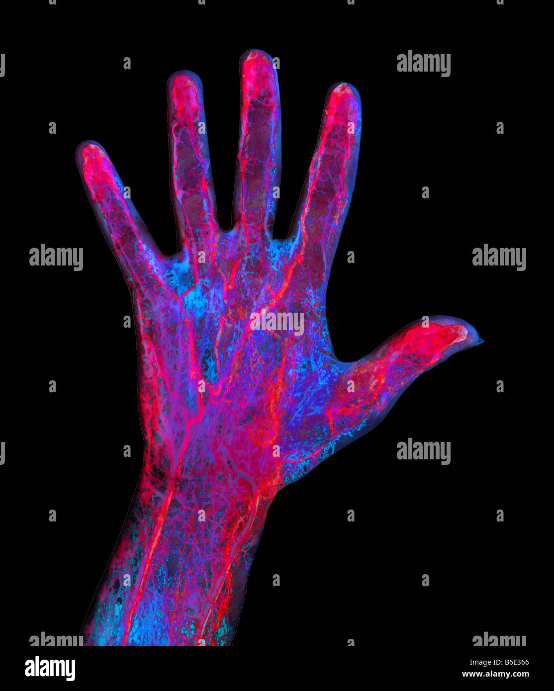 Hand blood supply Stock Photo - Alamy