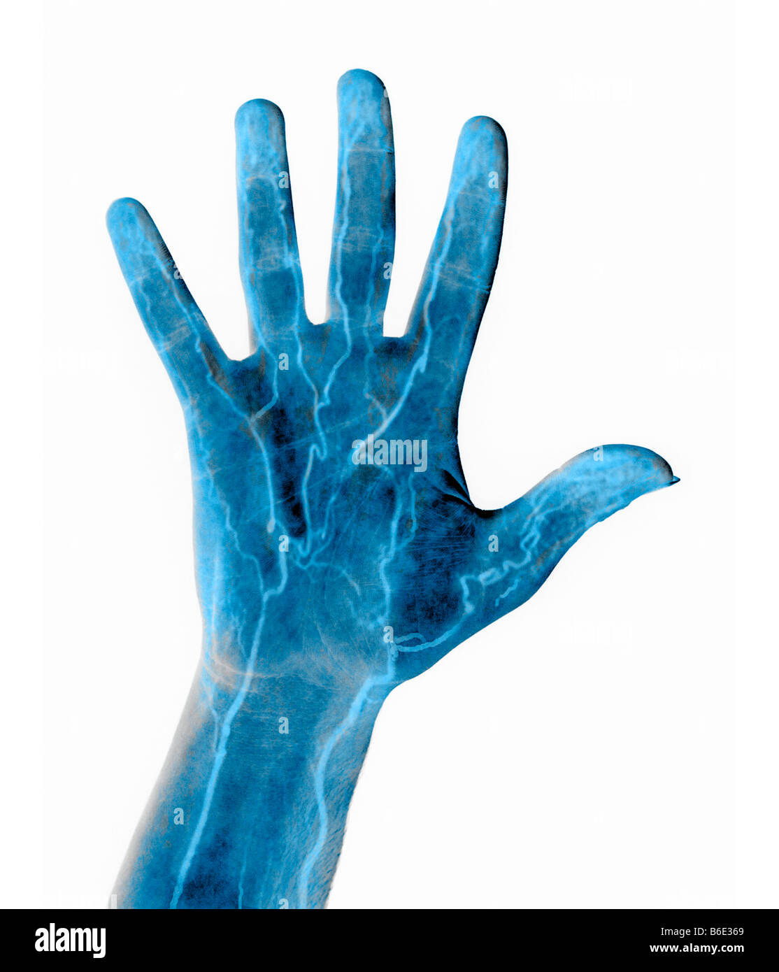 Hand blood supply Stock Photo - Alamy