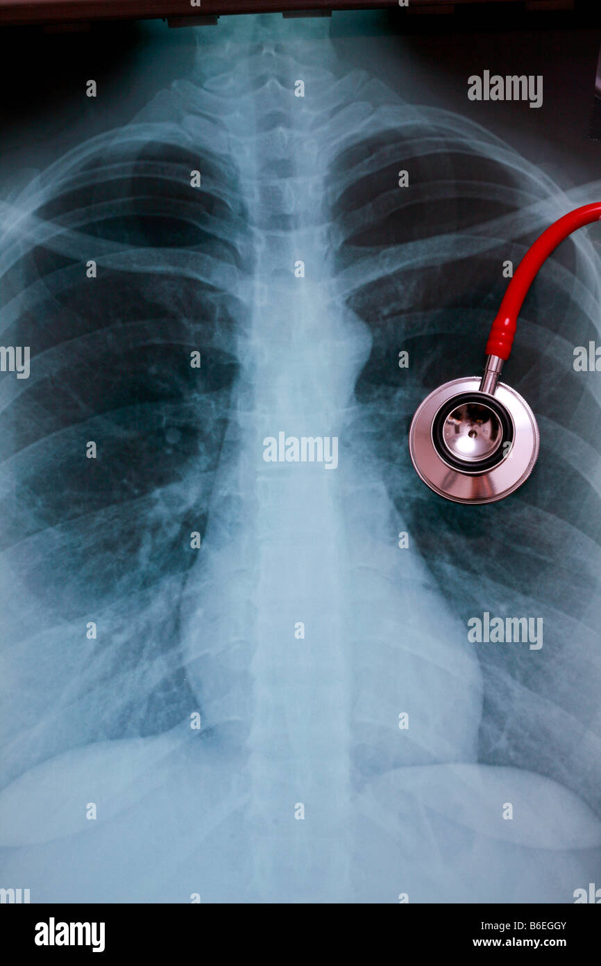 Chest xray machine hi-res stock photography and images - Alamy