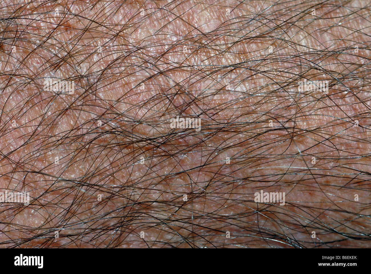 Skin of adult mans arm Stock Photo - Alamy