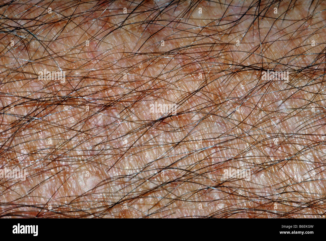 Skin of adult mans arm Stock Photo - Alamy