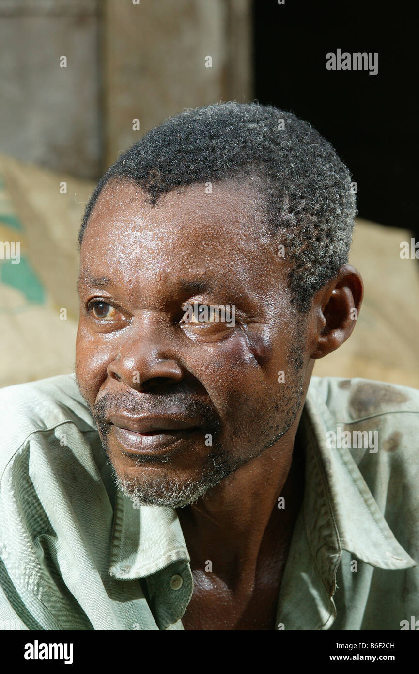 AIDS/HIV positive woman, portrait, Manyemen, Cameroon, Africa Stock ...