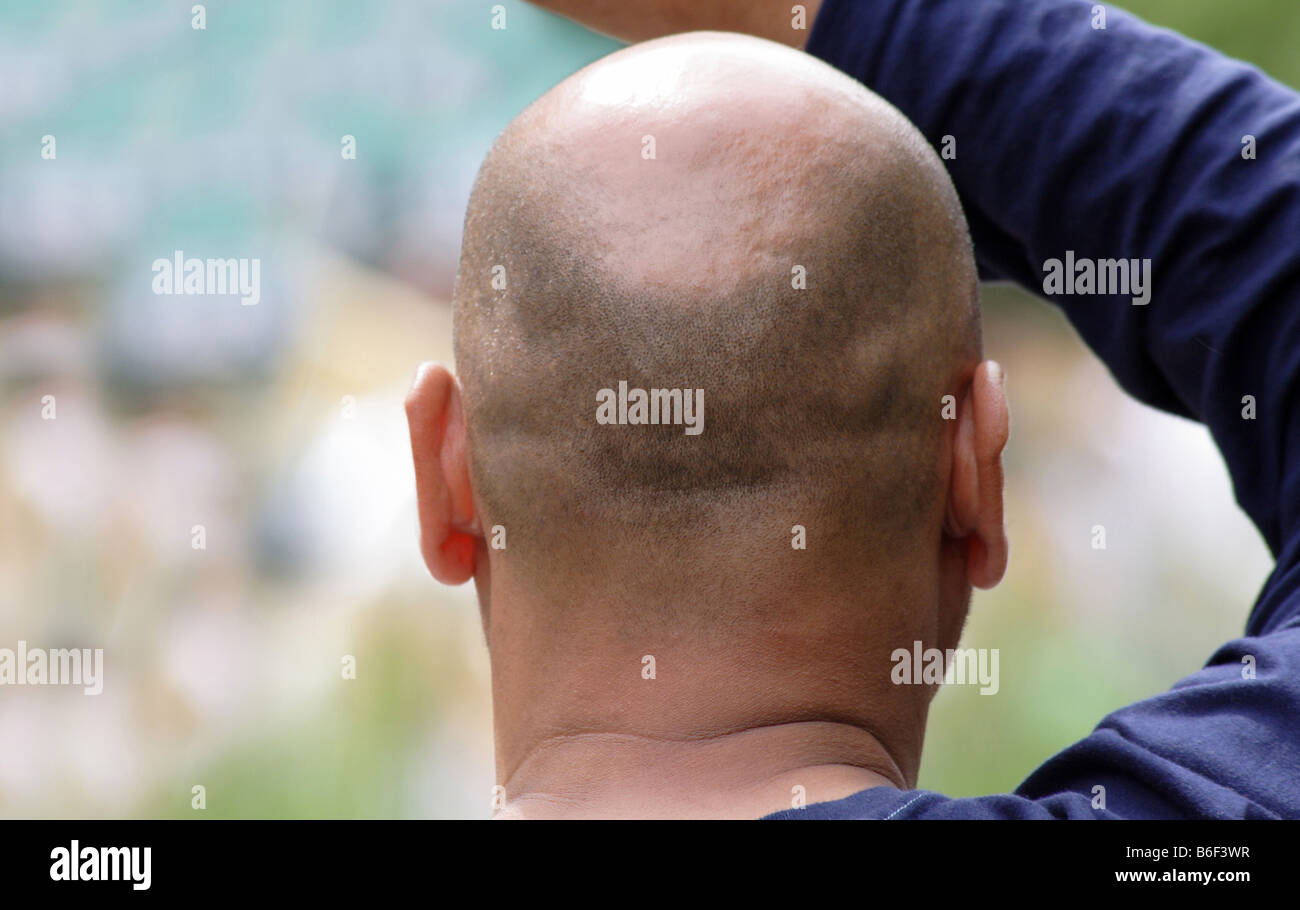 man with bald head, rear view Stock Photo - Alamy