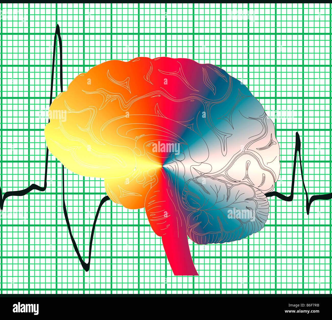 computer enhanced view of brain and Electrocardiogram EKG graph ...