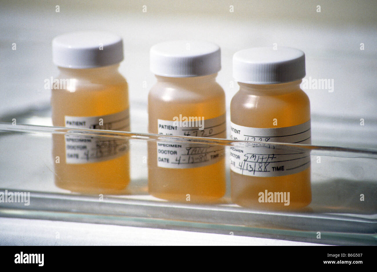 Bottles of urine samples on shelf in lab Stock Photo - Alamy