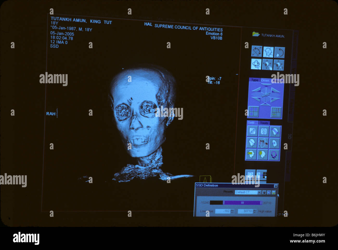 Egypt, CT scan of Tutankhamun Stock Photo - Alamy