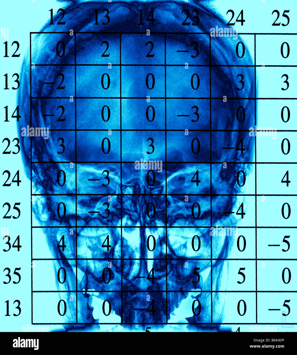 Medical diagram hi-res stock photography and images - Alamy
