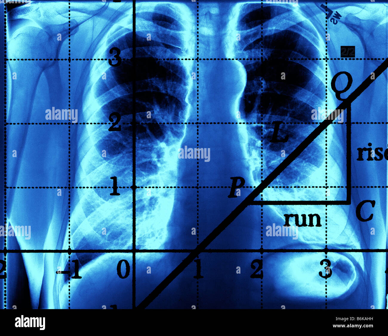 Medical diagram hi-res stock photography and images - Alamy