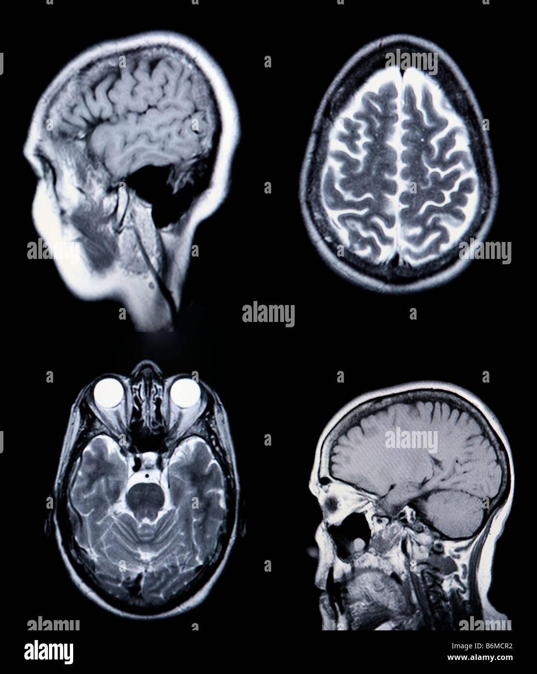 Resolution ct of the human brain hi-res stock photography and images - Alamy