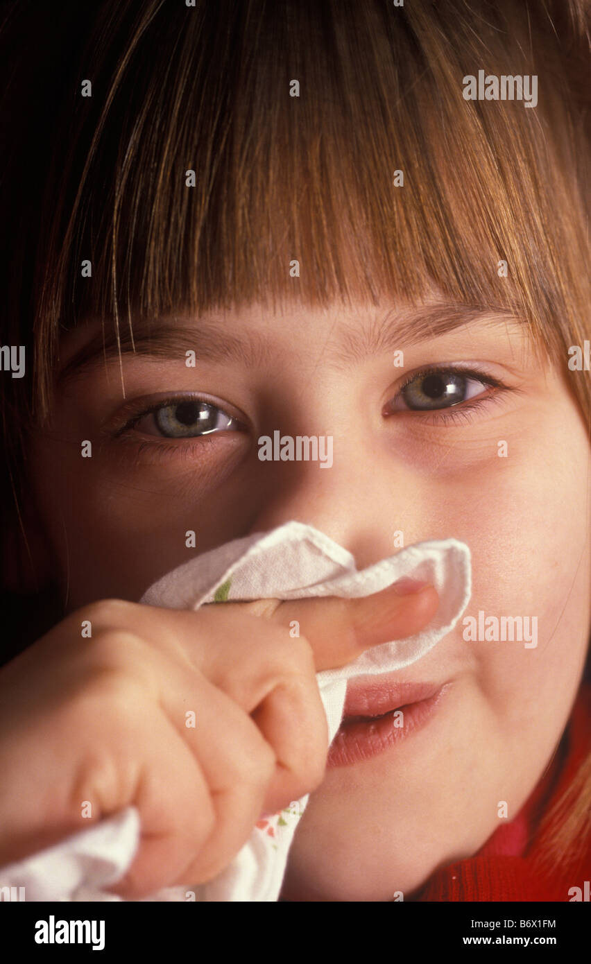 young child with cold and soreness under her nose from rubbing and ...