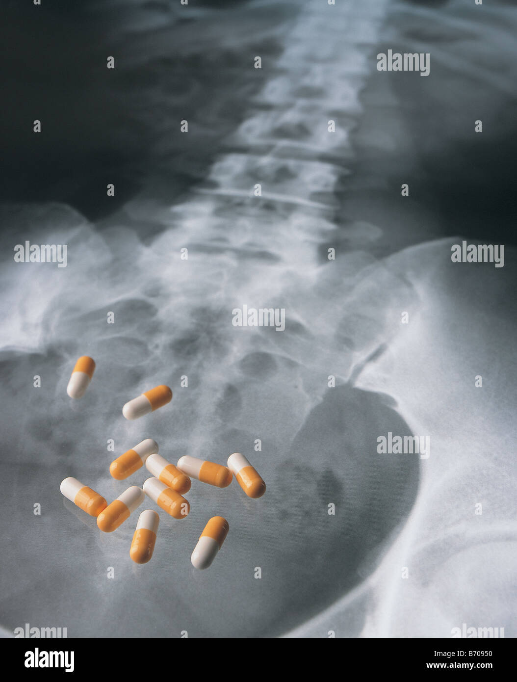 Ray bone pills hi-res stock photography and images - Alamy
