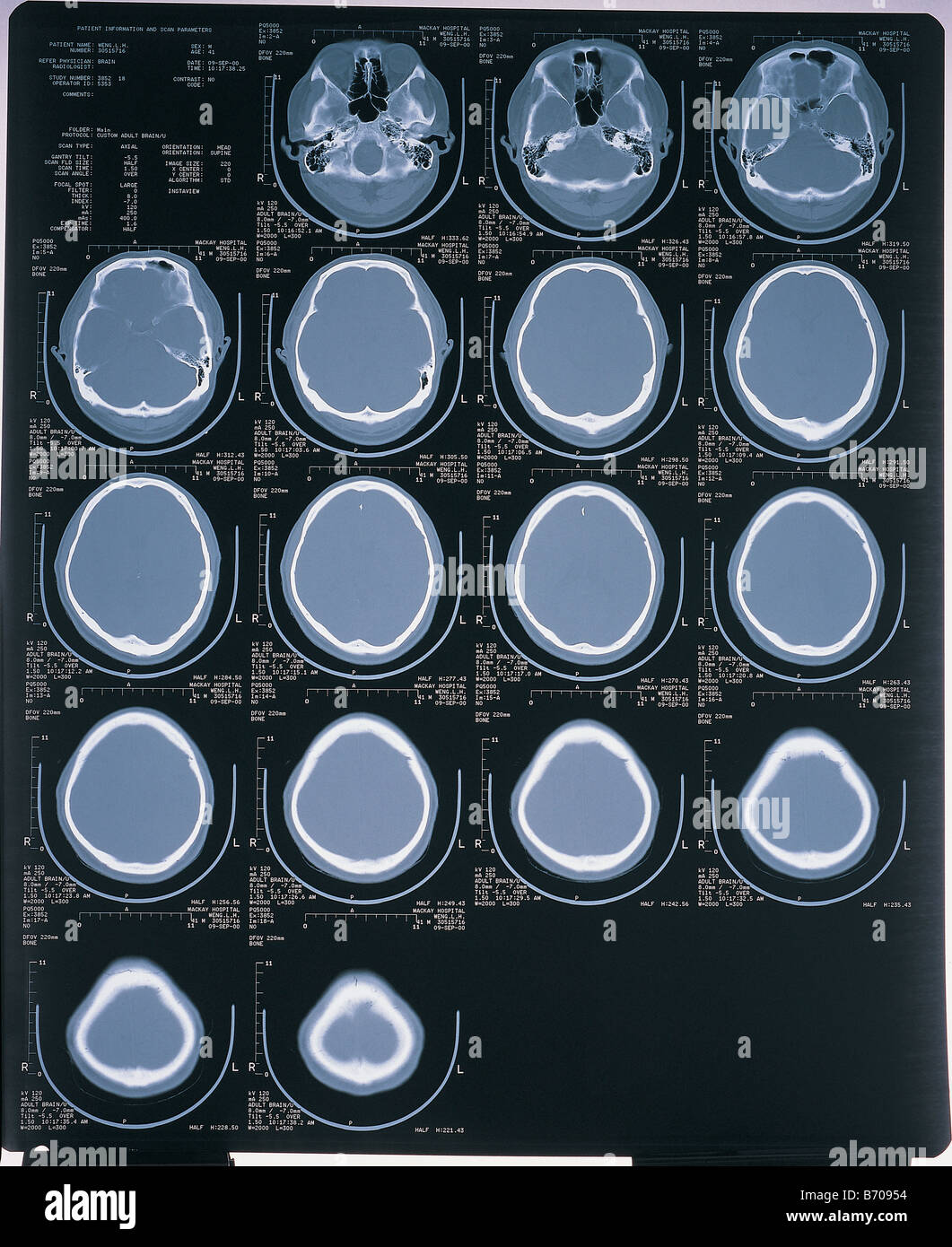 brain scan file Stock Photo - Alamy