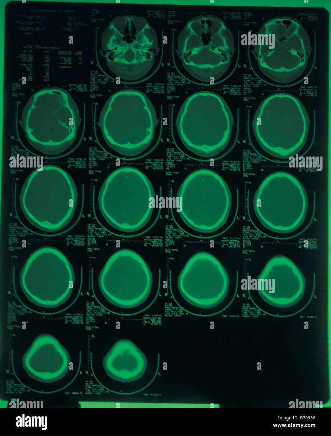 brain scan file Stock Photo - Alamy