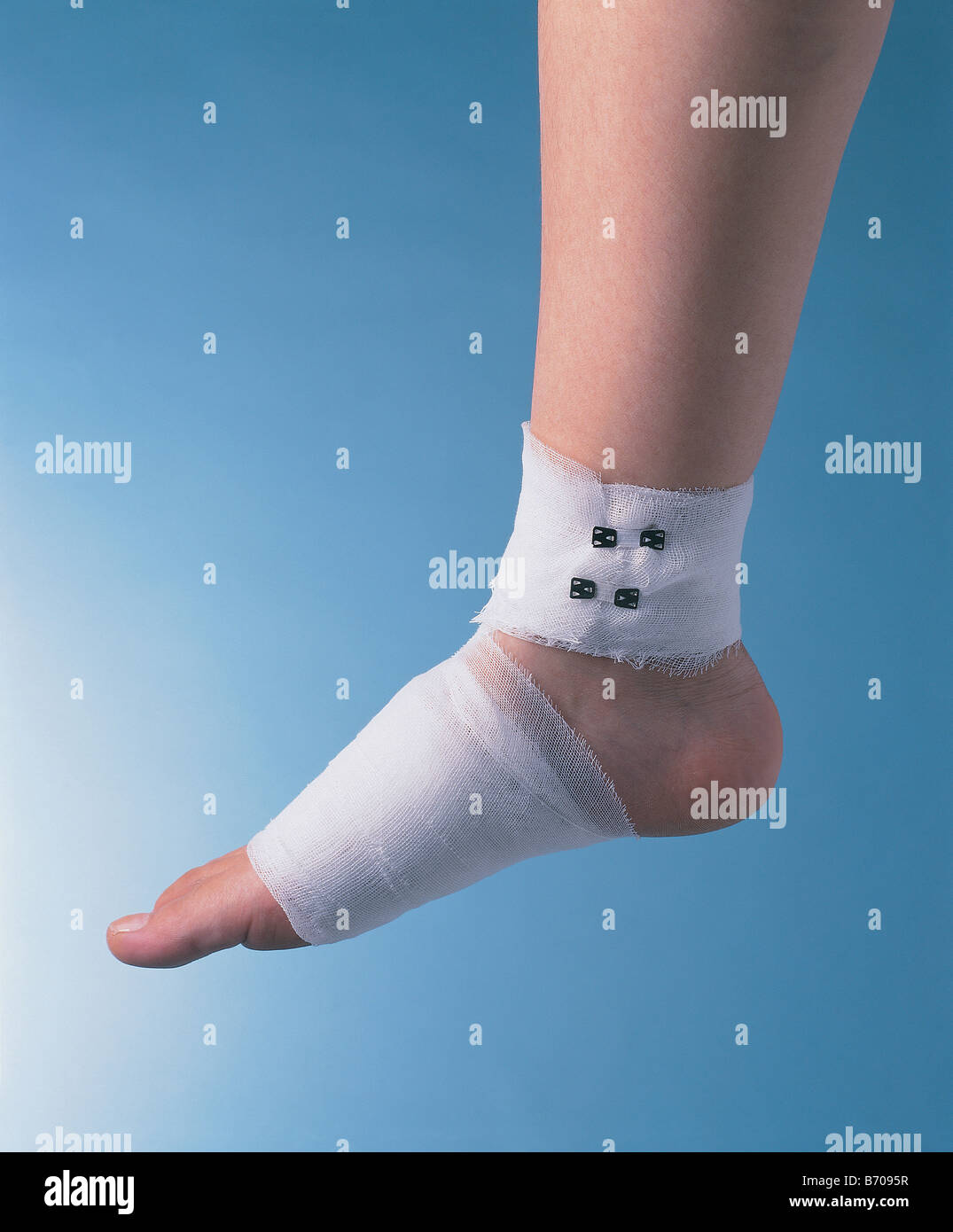 foot in bandage Stock Photo - Alamy
