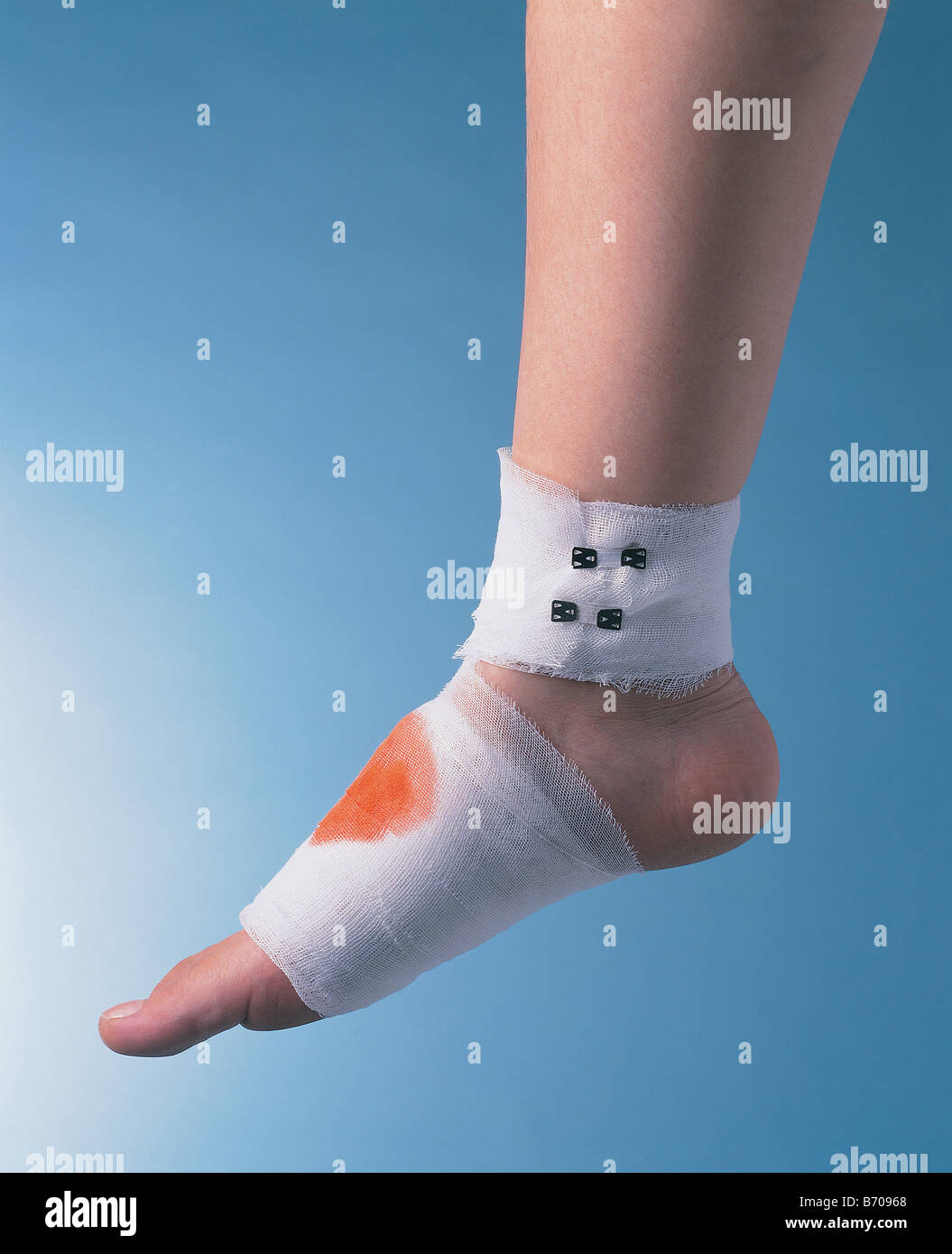 foot in bandage Stock Photo - Alamy