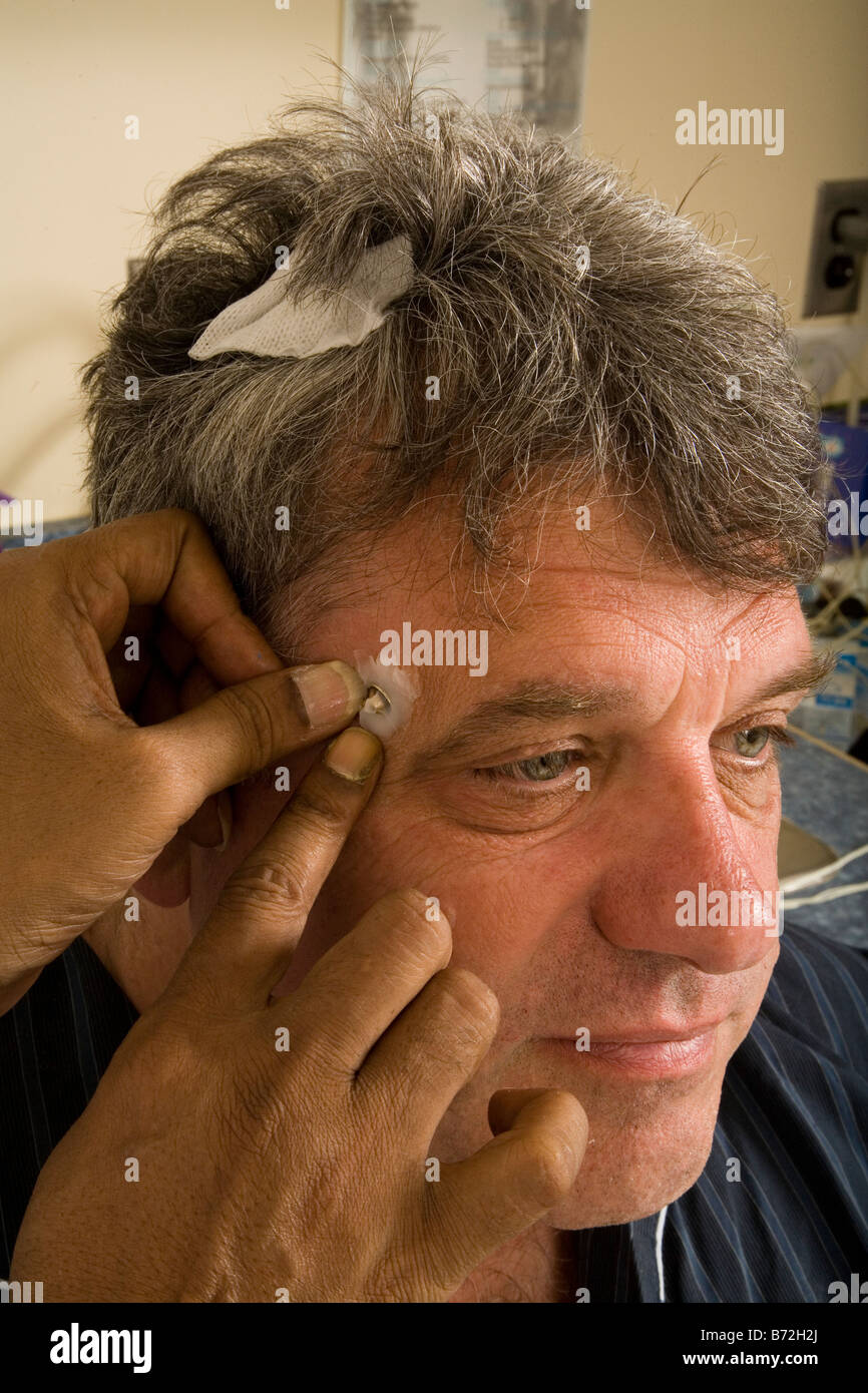 Man being wired for testing Stock Photo - Alamy