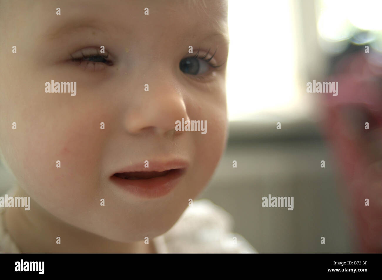 Orphan with one eye at an orphanage in Ukraine Stock Photo - Alamy