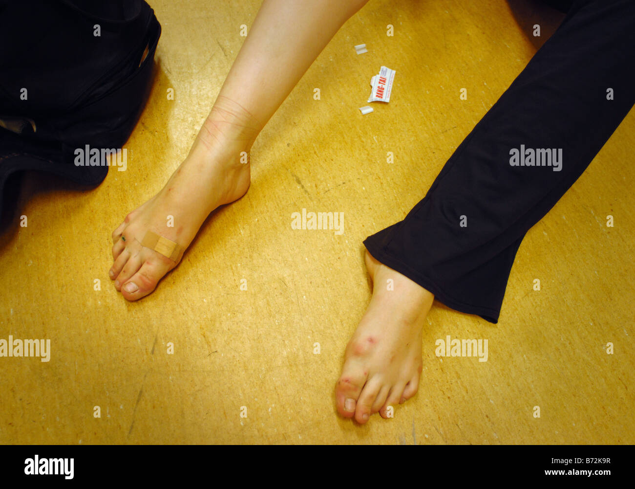 A ballet dancers sore feet behind scenes during rehearsals in Poland ...