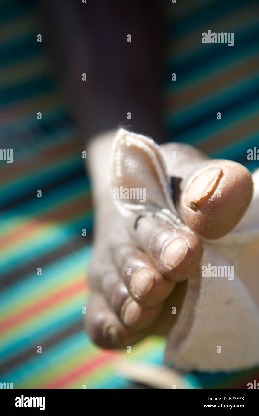 Man holding cloth Between toes Stock Photo - Alamy