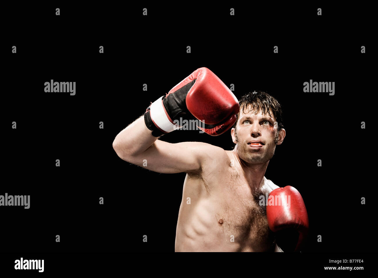 Chest Bruise Stock Photos & Chest Bruise Stock Images - Alamy