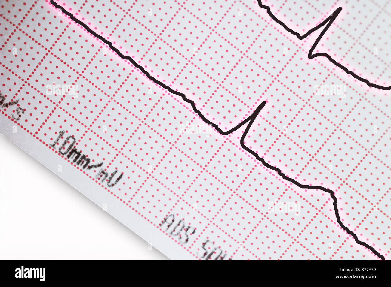 Electrocardiographs hi-res stock photography and images - Alamy