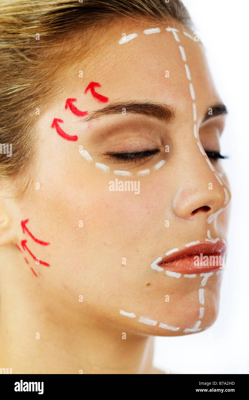 Young woman with lines on her face for cosmetic surgery Stock Photo - Alamy