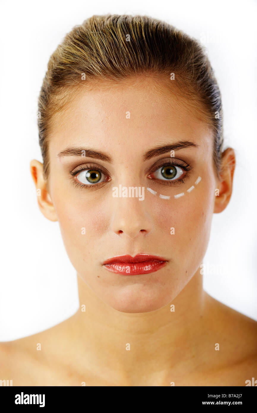 Young woman with lines on her face for cosmetic surgery Stock Photo - Alamy