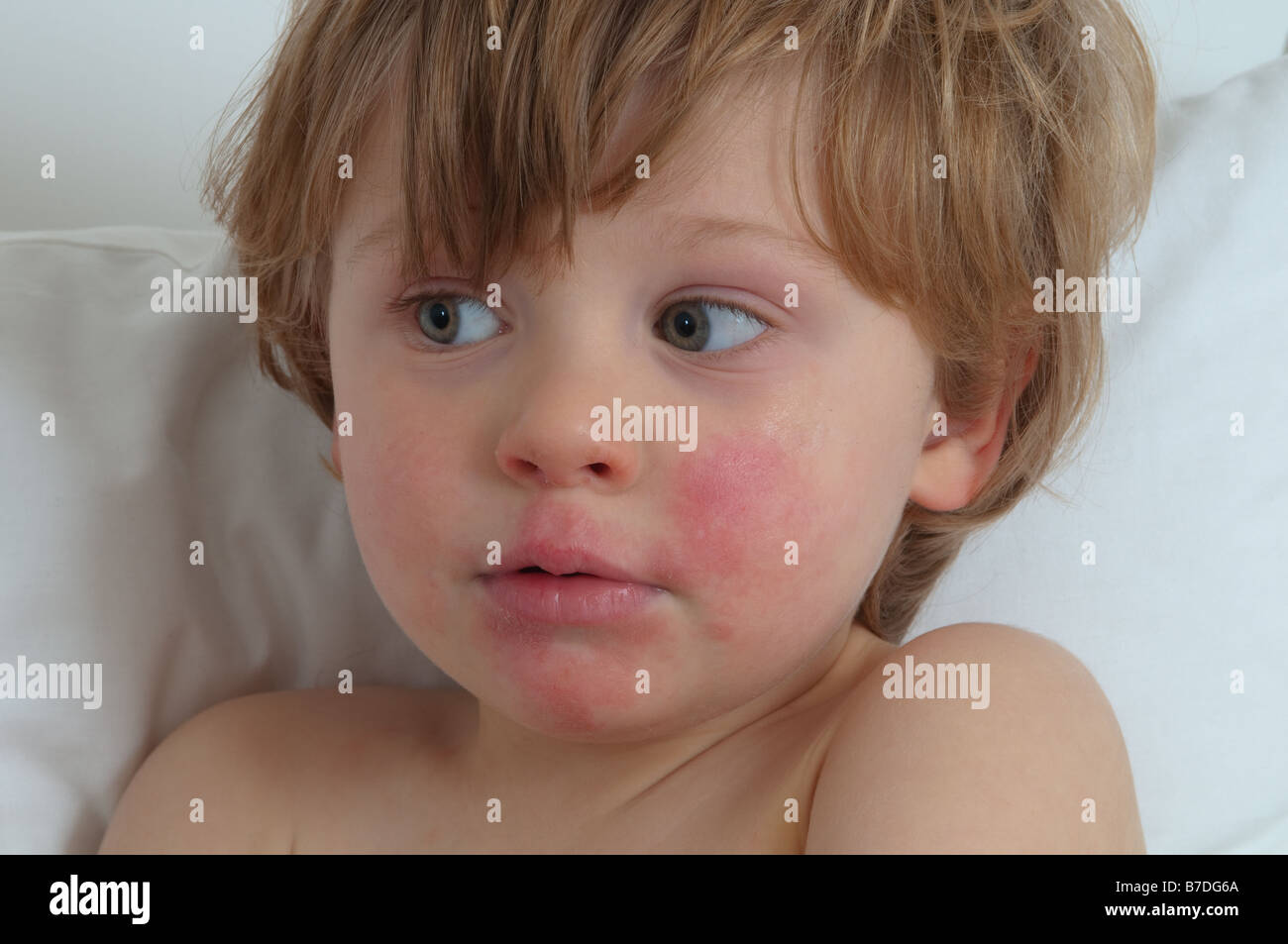 Sickly child hi-res stock photography and images - Alamy