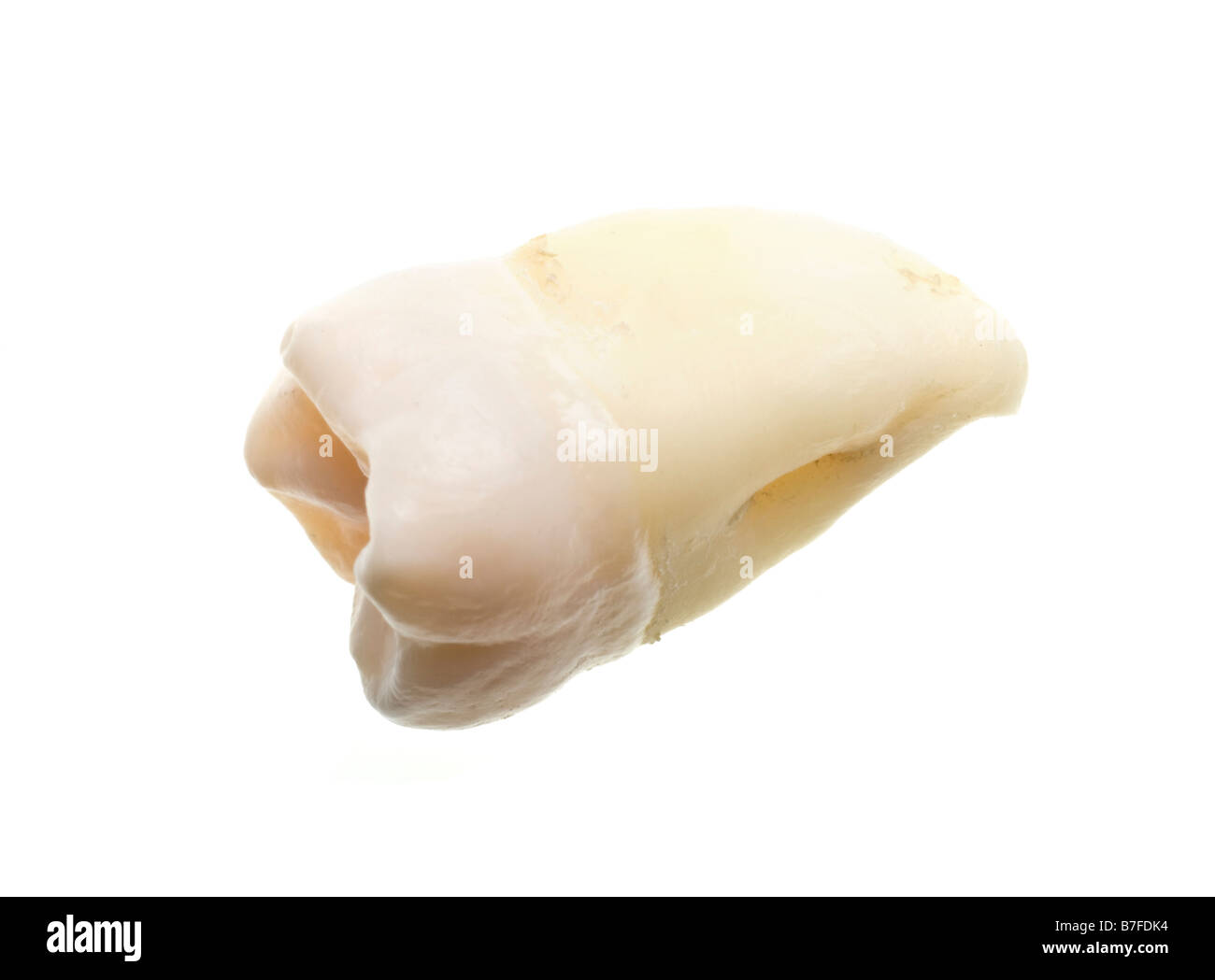 Wisdom tooth hi-res stock photography and images - Alamy