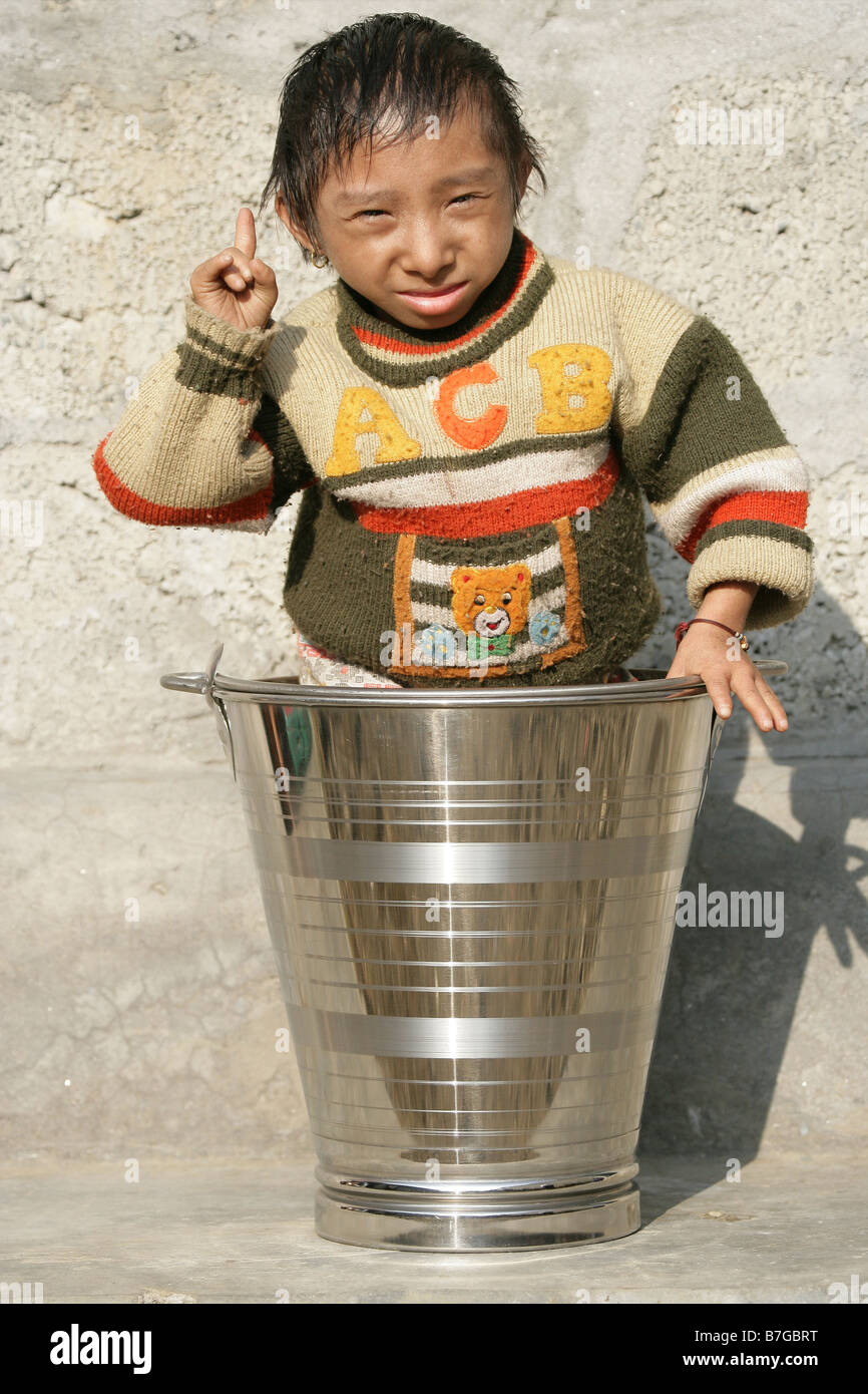 The Smallest Head In The World