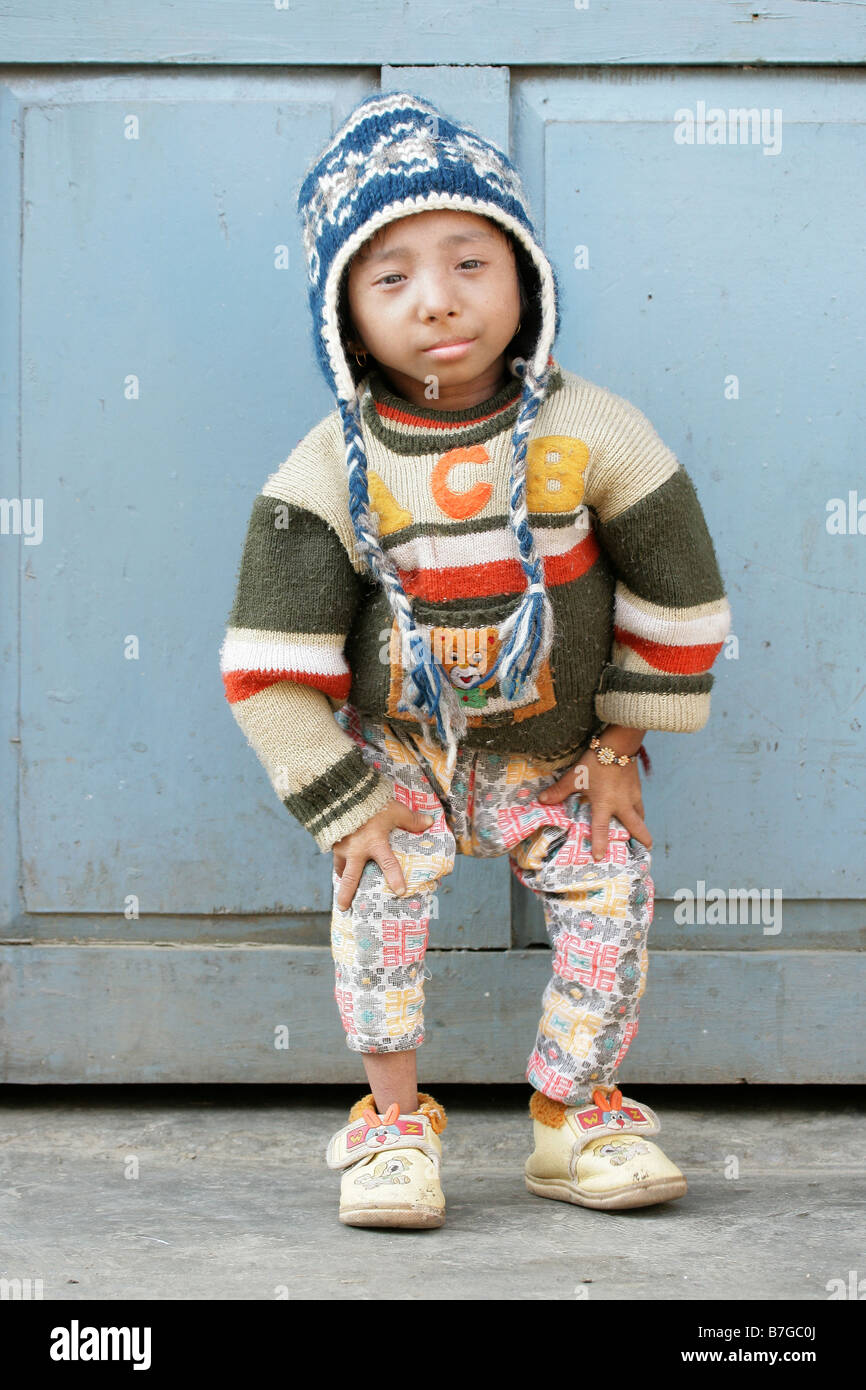 Eighteen year old Khagendra Thapa Magar the worlds smallest man Stock ...