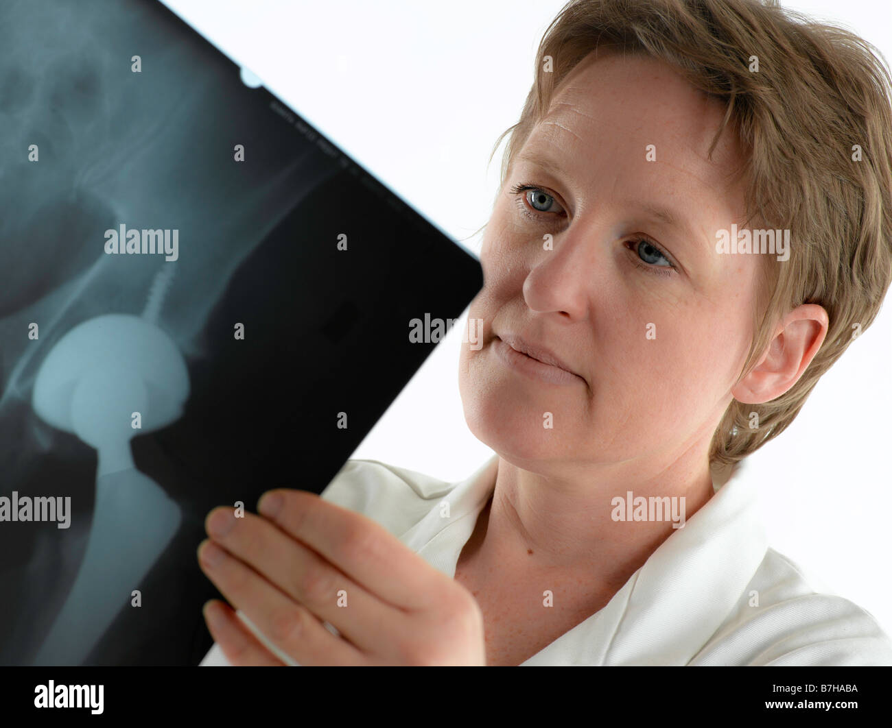 Young woman Doctor with xray of hip joint Stock Photo - Alamy