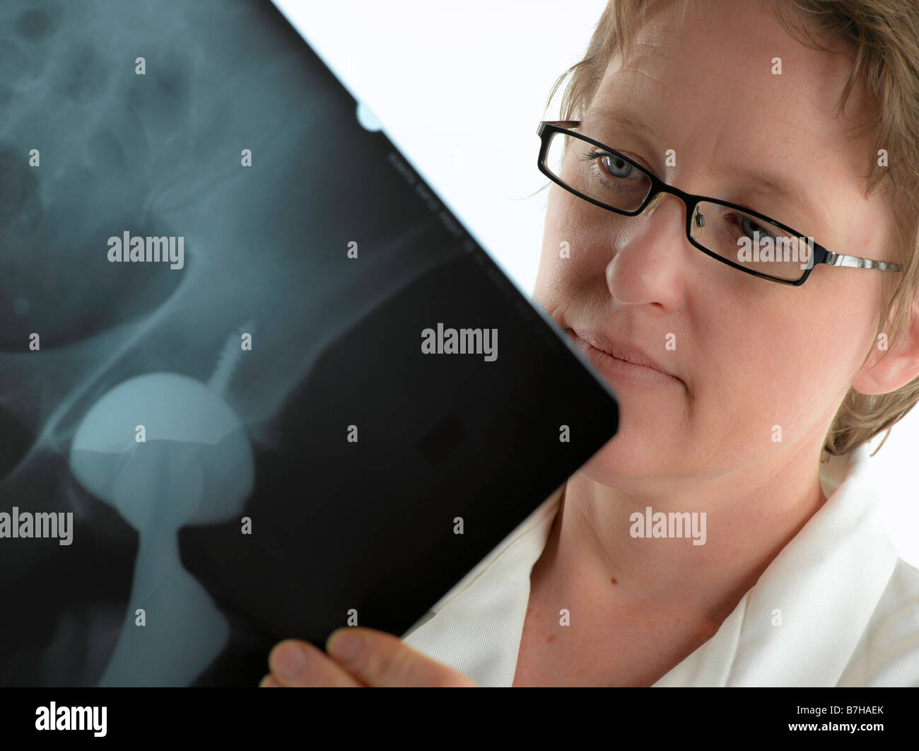 Hip replacement xray hi-res stock photography and images - Alamy
