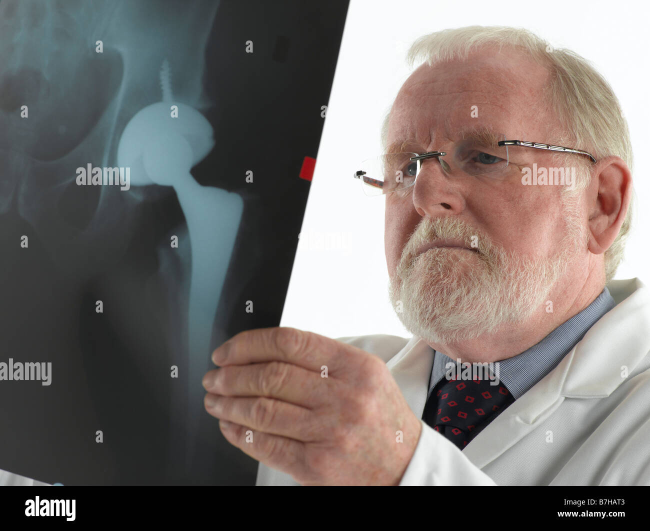 Hip replacement hi-res stock photography and images - Alamy