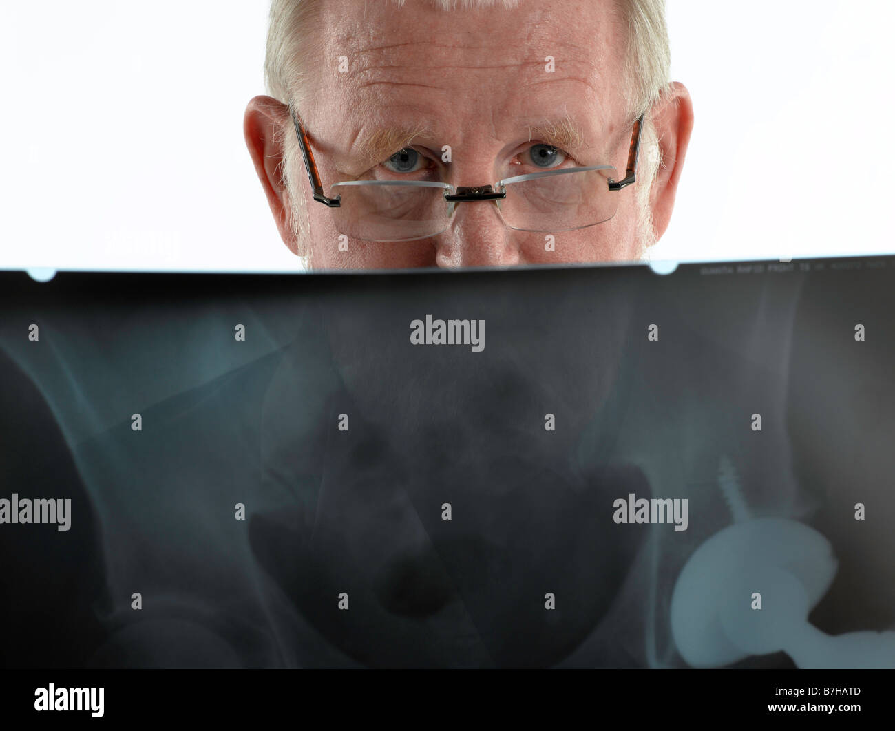 X ray pelvis hi-res stock photography and images - Alamy