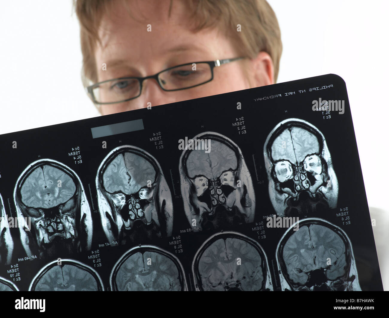Doctor examine mri scan hi-res stock photography and images - Alamy