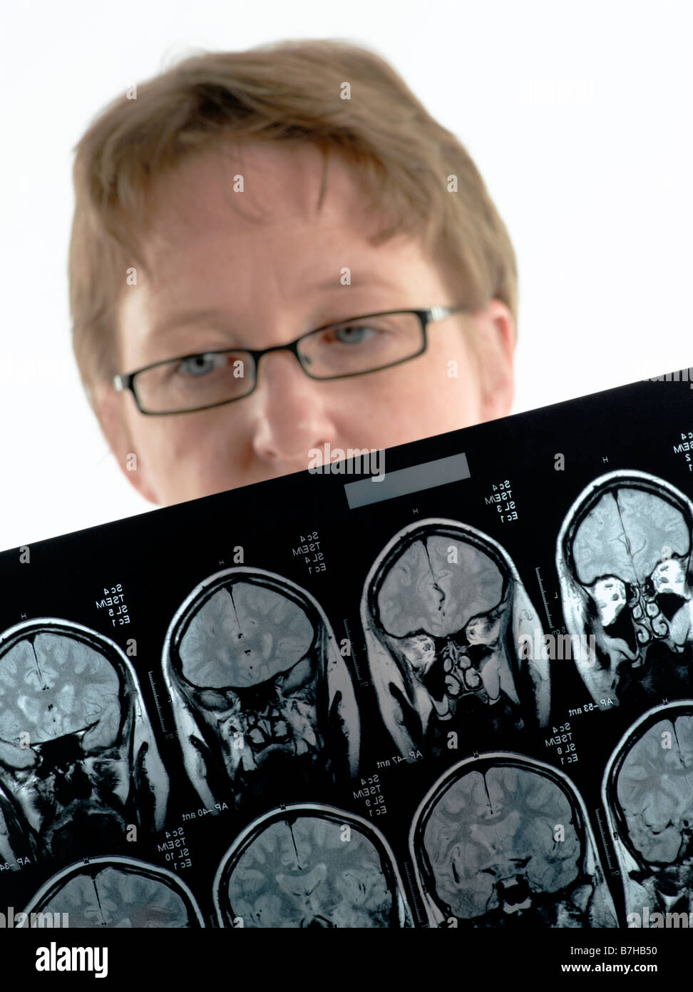 YOUNG WOMAN DOCTOR WITH MRI SCAN OF BRAIN Stock Photo - Alamy