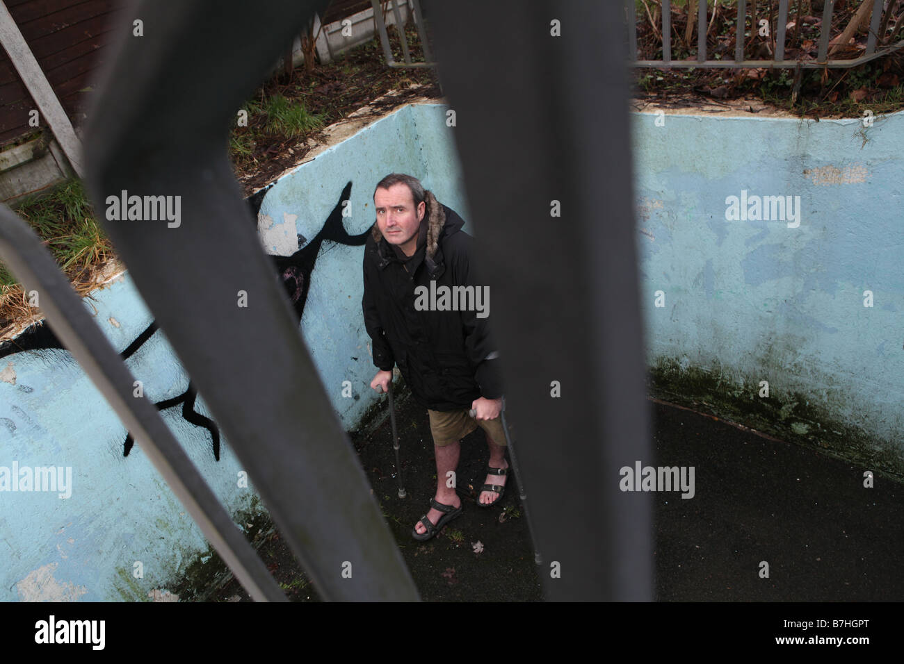 a portrait of a man with a broken ankle that has been waiting for over ...