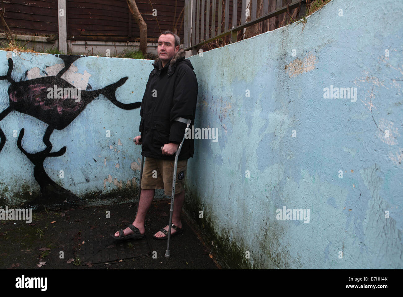 a portrait of a man with a broken ankle that has been waiting for over ...