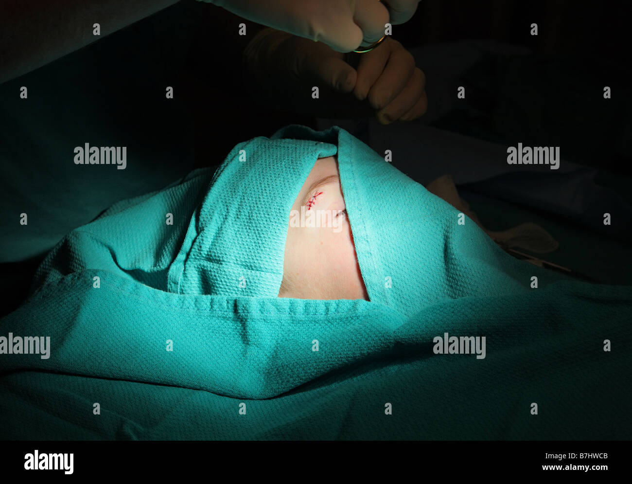 Stitches cut hi-res stock photography and images - Alamy